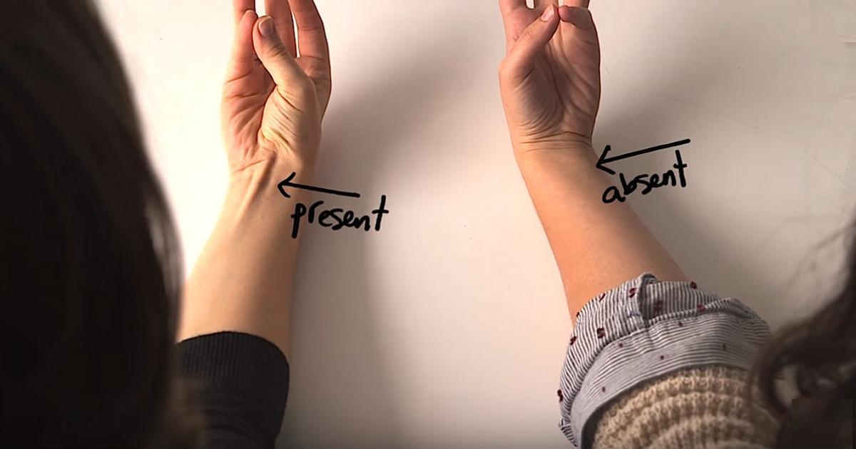 Le tendon de votre poignet est-il visible? Quand j'ai su ce que ça ...