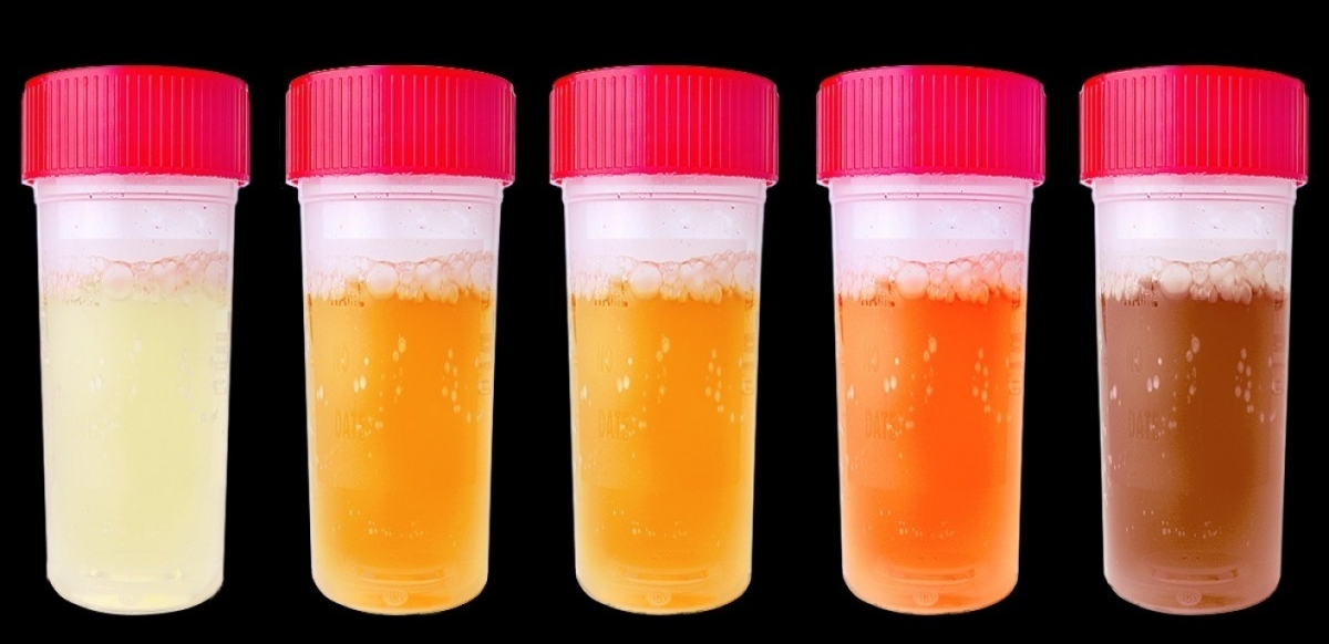 La couleur de ton urine peut te révéler différentes choses sur ta santé ...